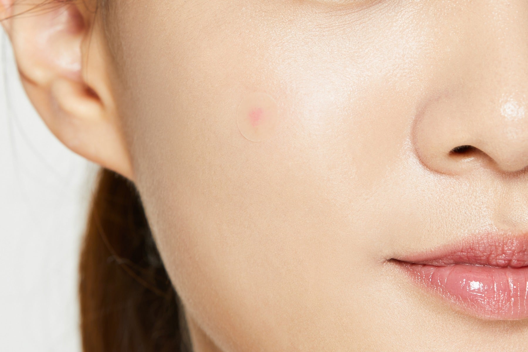 ACNE PIMPLE MASTER PATCH | Laboratory K